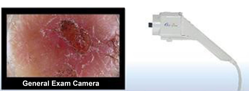 Video Rectoscope By Rebonson - Avs